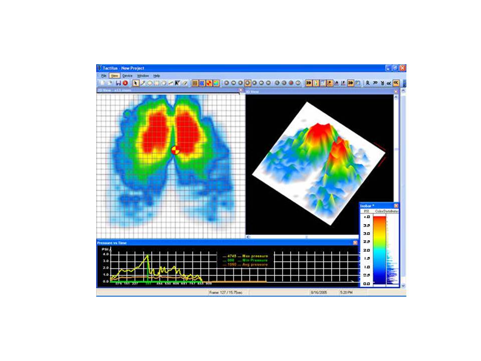 Pressure Mapping: A Valuable Resource for Client Assessment & Education ...
