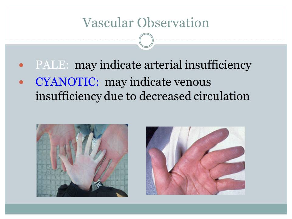 The Hand 101 - Article 2223