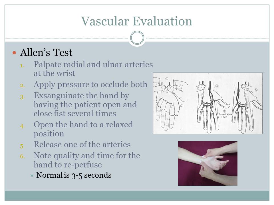 The Hand 101 - Article 2223