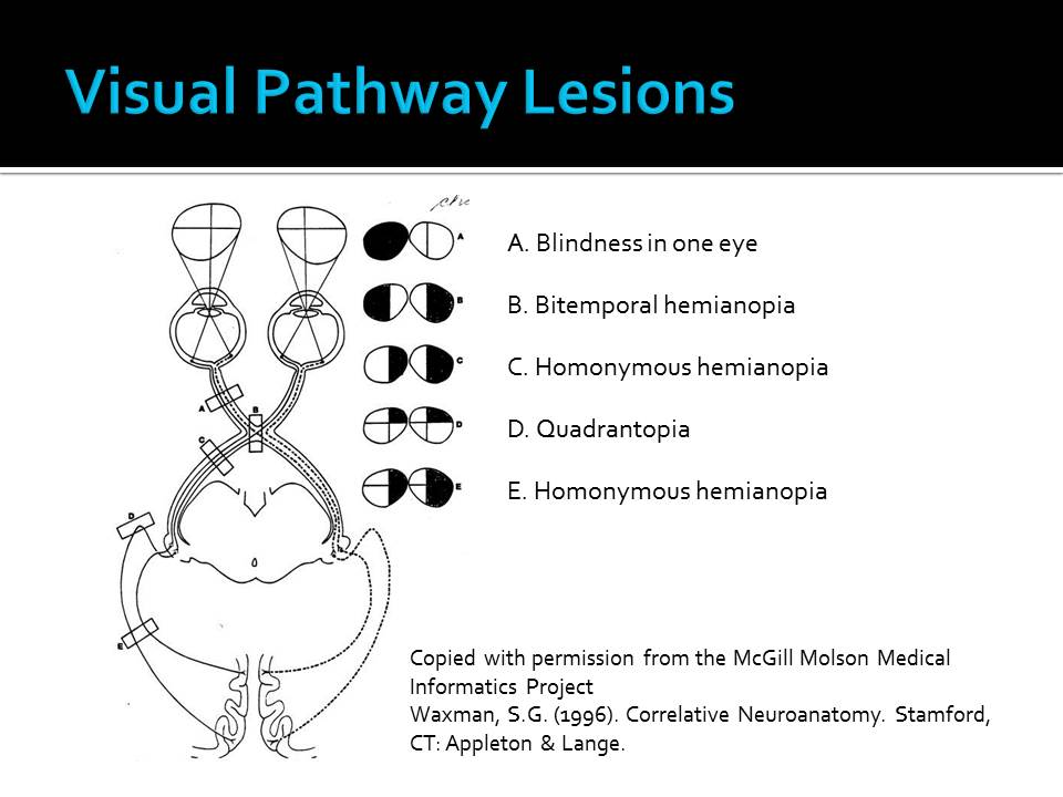 Low Vision Assistive Technology and Community Adaptation for People ...