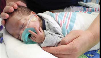 Developing In The NICU: An Introduction to Positioning & Handling, Part ...